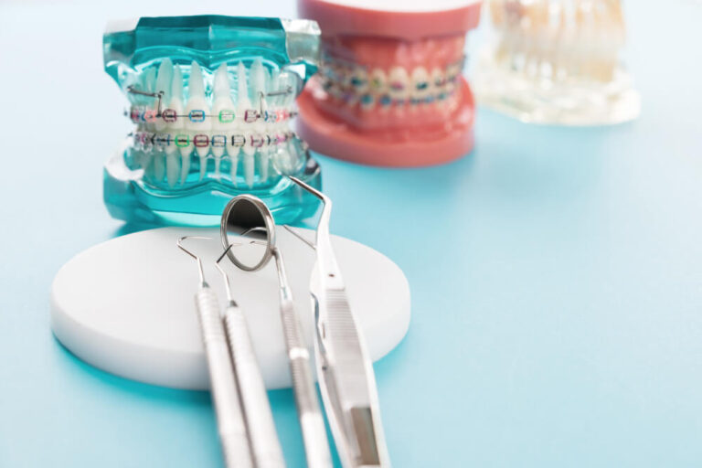 Orthodontics | Dental Adjustments for a Confident Smile!